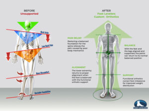 Orthotics – Evolve Wainwright
